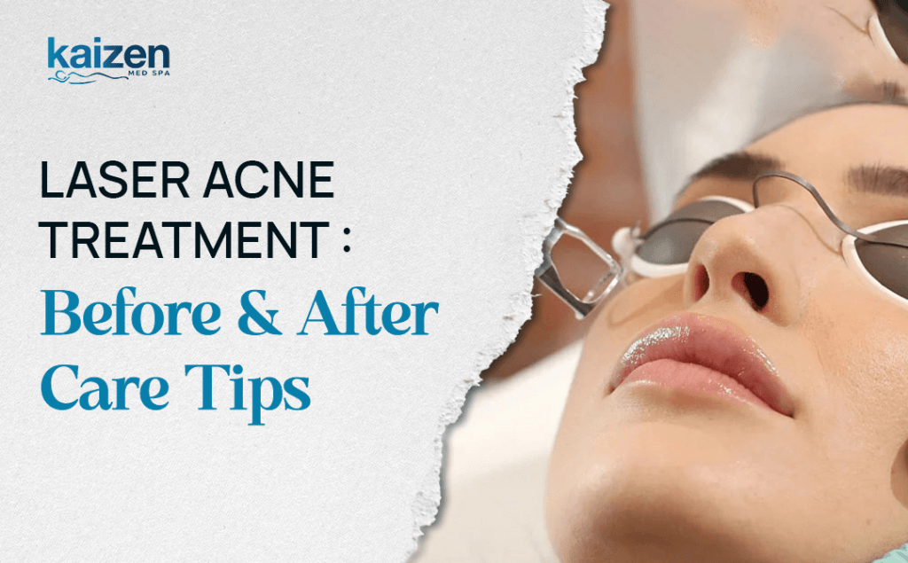 Laser Acne Treatment: Before and After Care Tips