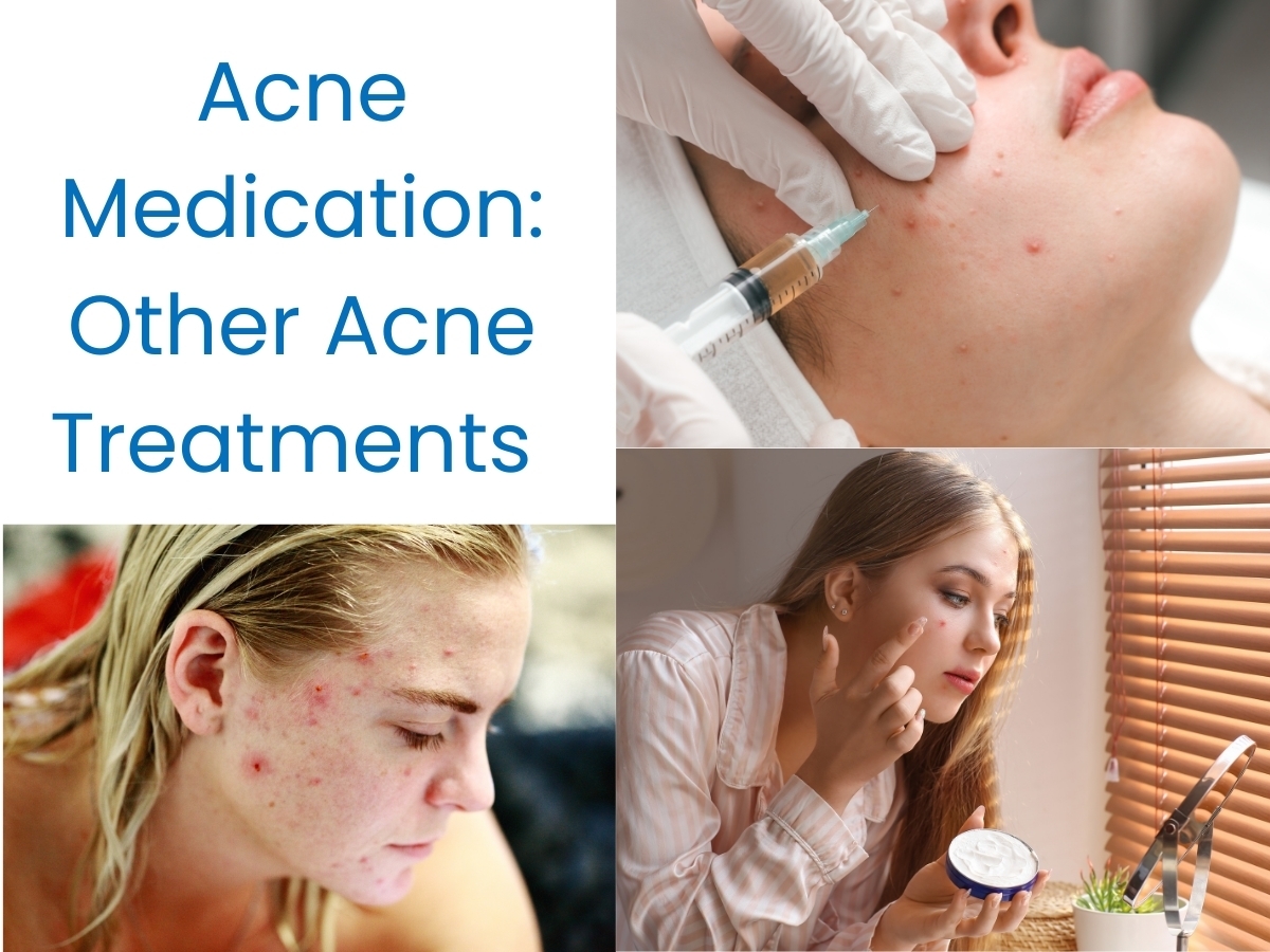 Acne Laser Treatment vs Traditional Acne Treatments