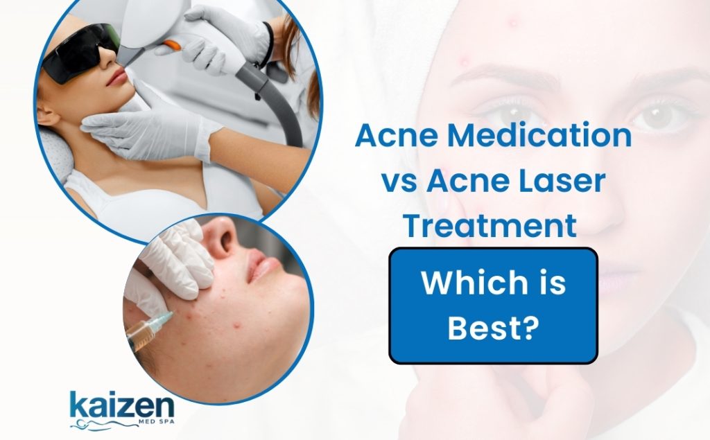 Acne Laser Treatment vs Traditional Acne Treatments