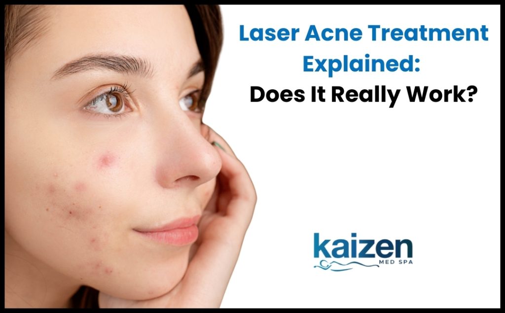 Laser Acne Treatment Explained: Does It Really Work? – Kaizen Medspa